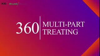 laser hair removal treatment