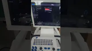 Trolley color doppler Ultrasound Diagnostic System