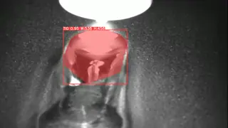 Real Time Welding Pool Inspection Camera AI Quality Control Monitoring