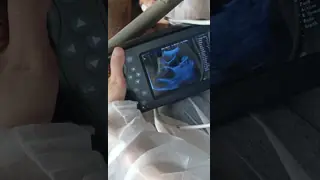 Handheld veterinary digital ultrasound scanner