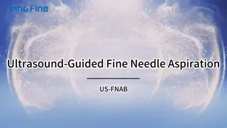 Ultrasound-Guided Fine Needle Aspiration