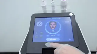 remove moles, warts and wrinkles plasma machine