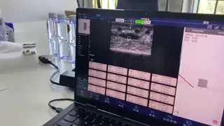 Precision Puncture Guidance Linear Ultrasound Probe