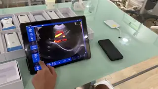 Wireless Dual Head Ultrasound Probe for Human and Vet Use