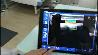 128 Element Dual Head Wireless Ultrasound Probe