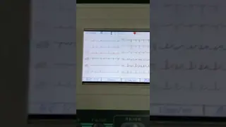 BR-ECG02B 3 Channel Interpretive ECG Machine
