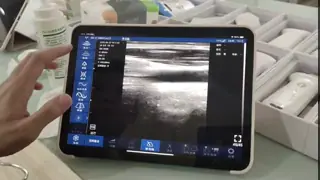 Wireless Handheld Ultrasound 192 Element POCUS System