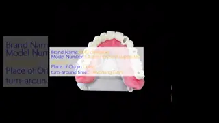 Full Arch Implant Supported Dentures Durable Precision Fit