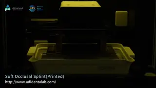 Custom 3D Printed Night Guard for Teeth Grinding Relief