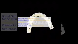 High Strength PFM Implant Bridge Precision Fit