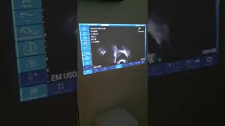 Portable Transvaginal Ultrasound for Modern Gynecology
