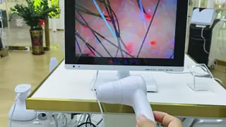 Hair analyzer machine 661