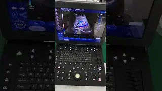 4D Portable color doppler machine BR-US15(V3.0)