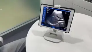 Wireless Handheld Ultrasound All In Solution