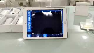Dual Head Wireless Ultrasound Probe for OB GYN Diagnostics