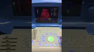 Ultrasound Machine BR-US07