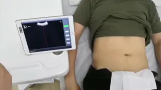 Wireless 4D Bladder Scanner BS1 Portable Point of Care