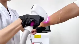 Professional 1000W Triple Wavelength Laser Hair Removal
