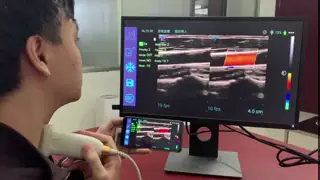iTrason USB linear ultrasound probe used on smart phone/PC