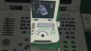 Full-digital laptop Ultrasound Diagnostic System 80element BR-US11