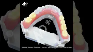Custom Flexible Dentures with a natural fit and lasting comfort.