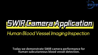 SWIR Camera Application – Human Blood Vessel Imaging Inspection