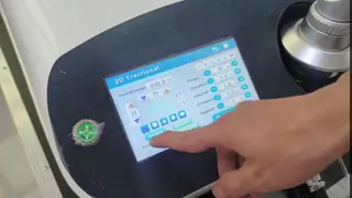 Advanced CO2 Laser Workstation for Acne Scars and Skin