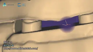 Premium Dental Restorations Fast Turnaround