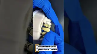 Custom full metal crown dental lab