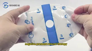 NPWT Film Dressing Video