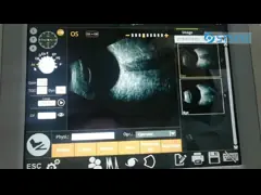 Ophthalmic Ultrasonic Scanner Machine Auto High Accuracy For Eyeball