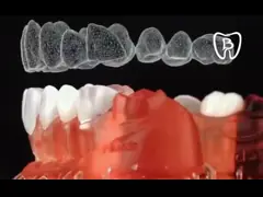 Zirconia Denture Dental lab Teeth High Hardness CAD / CAM Technology