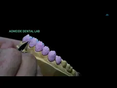 치아 복원 용하기 좋은 톱니 다리