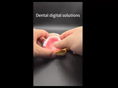 자연스러운 외모의 치아 치아 기반 바이오 호환성 樹脂 최적의 환자 편안함