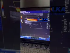 original ge ultrasound equipment portable ultrasound machine