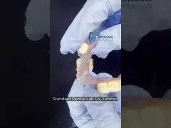 Ευέλικτες οδοντοστοιχίες Valplast για φυσική άνεση και αισθητική ποιότητα