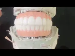 porcelain all on four zirconia bridge high esthetics dental implant bridge