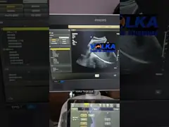 atl cx50 epiq curved array original ultrasound probe c5-1 for ob/gyn