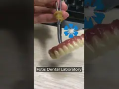 zirconia all-on-4 implant procedure same day recovery minimal follow up needed
