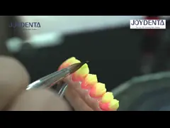 Saludos a una sonrisa impecable con carillas cosméticas sin decoloración sin preparación