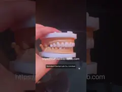 high esthetics white dental crown diagnostic wax up customized china dental lab