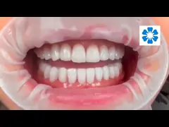 high translucency dental lab laminate veneers for natural and polishing