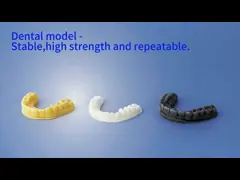 치과 3D 인쇄물 가이어 치과 3D 인쇄물