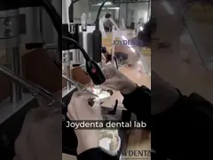 Implante corona y puente con diseño personalizable alta durabilidad ajuste preciso