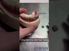 yellow resin temporary teeth smooth surface treatment precise and stable