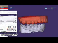 3d printed soft occlusal splints for bruxism comfort dental occlusal splint