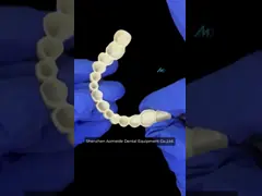 높은 투명성 지르코니아 치아 다리