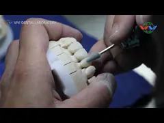 high esthetics full contour zirconia crown