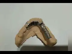 removable orthodontic invisible retainer easy maintenance beautiful transparent color