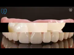 Natural Digital Dental Model Surface Rubber Smooth OEM Denture Dental Lab